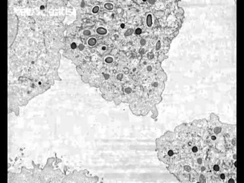 Researchers Surprised to Find Giant Viruses in Forest Soil | Microbiology