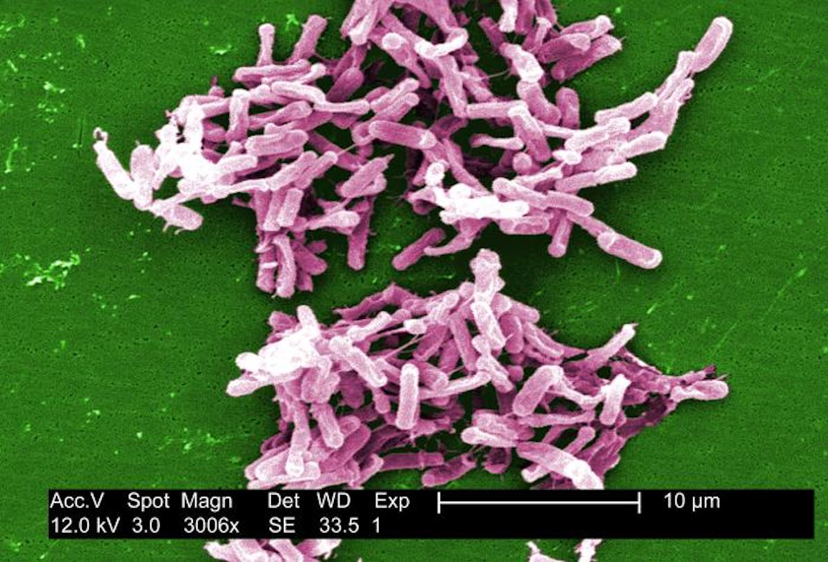 A Pathogen That Has Evolved to Spread in Hospitals | Genetics And Genomics
