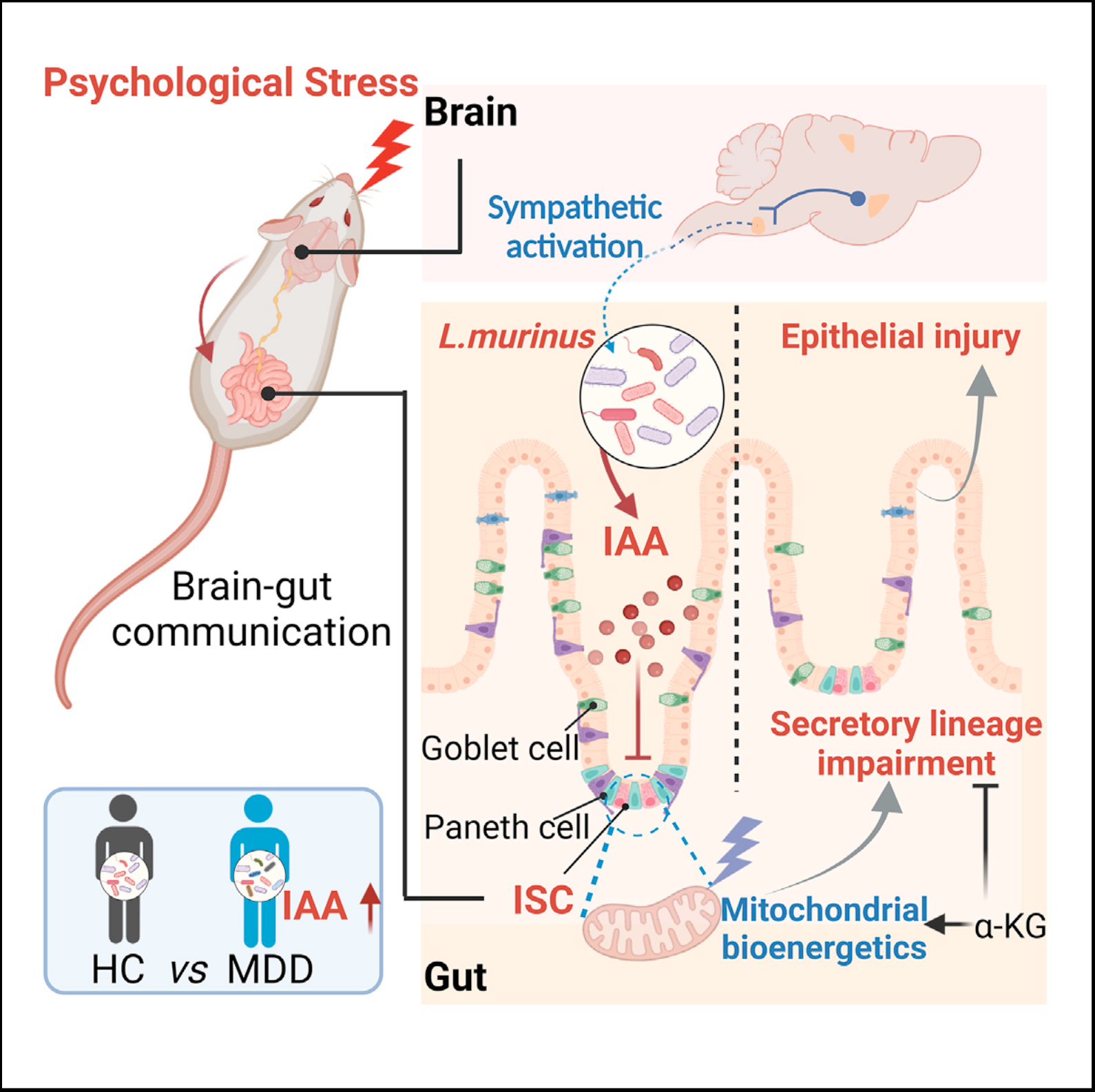 Bad Gut Feeling: Why Stress Messes with Your Digestion | Neuroscience
