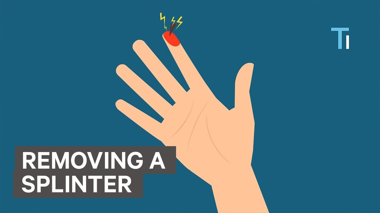 What's the Best Way to Treat a Splinter? | Videos