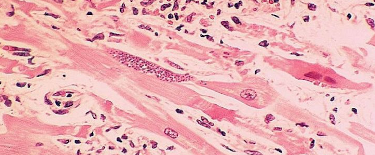 Extracellular Vesicles Help Heart Cells Survive A Heart Attack Cell