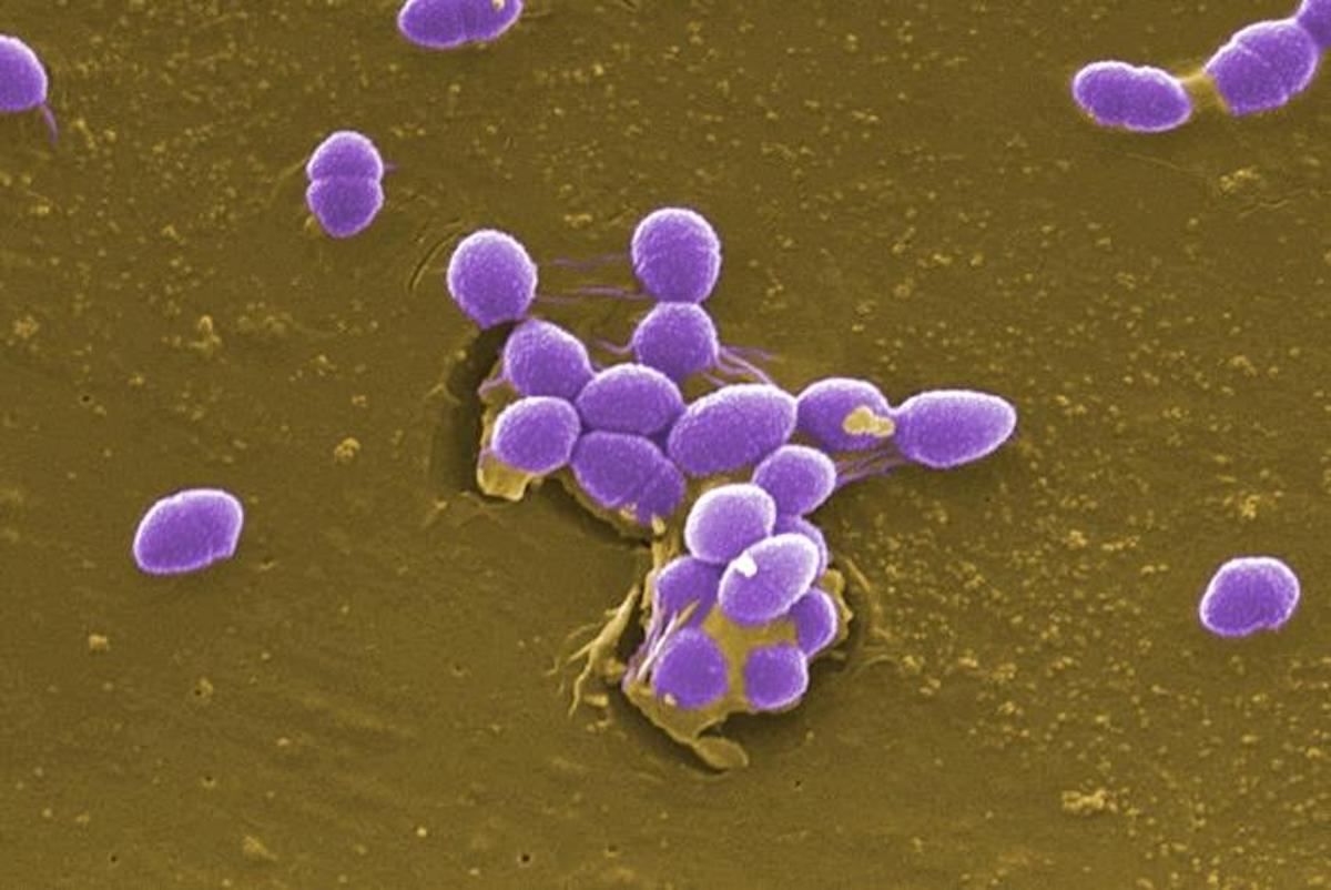 Scientists Trace the Evolutionary Path of a Hospital Superbug ...