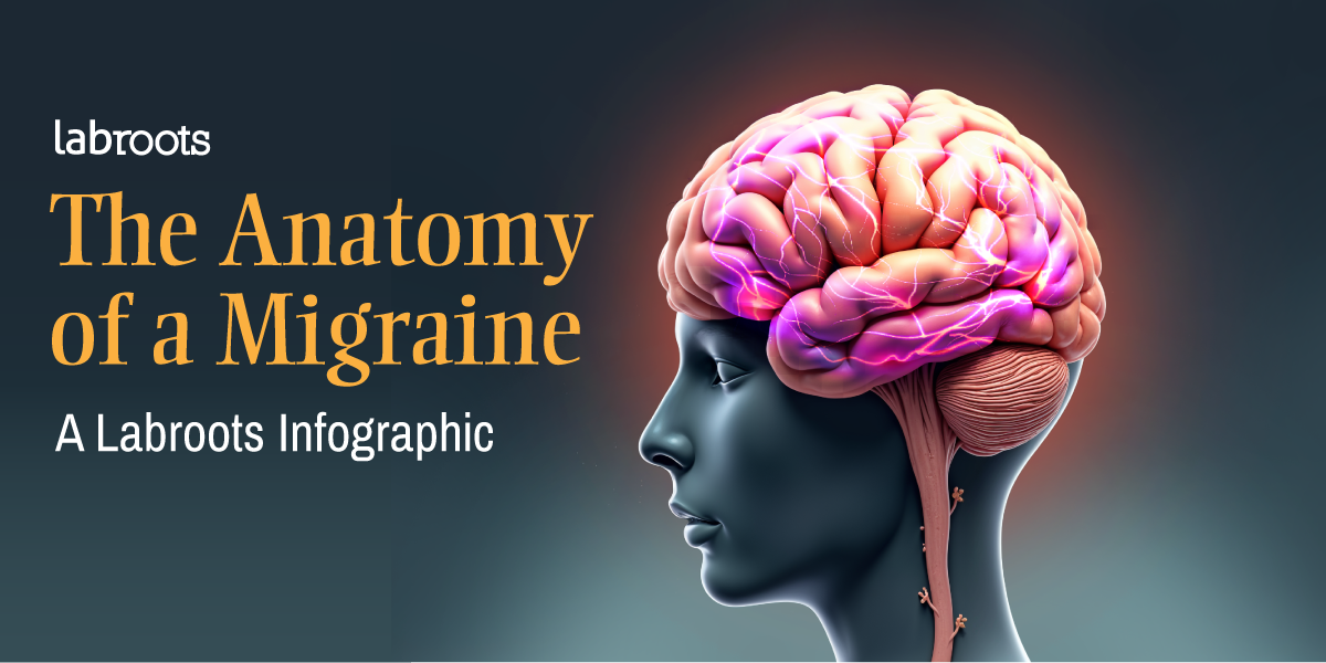 The Anatomy of a Migraine | Infographics