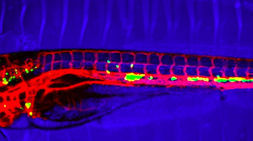 Zebrafish as Metastatic Cancer Model | Videos