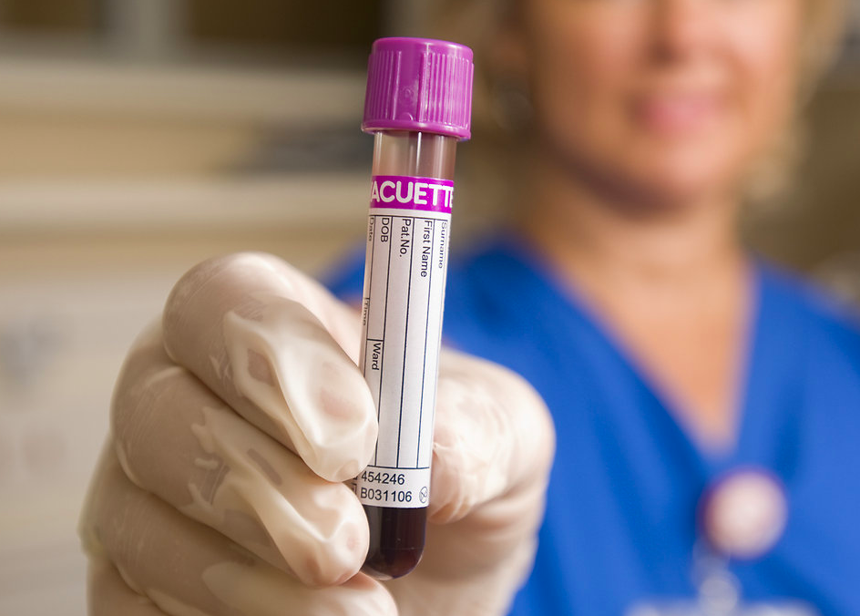 Saving Patients From Unnecessary Chemotherapy with a Blood Test | Cell ...