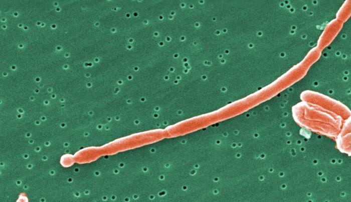 Scientists Learn Why UTIs Can Cause Lasting Pain | Clinical And ...