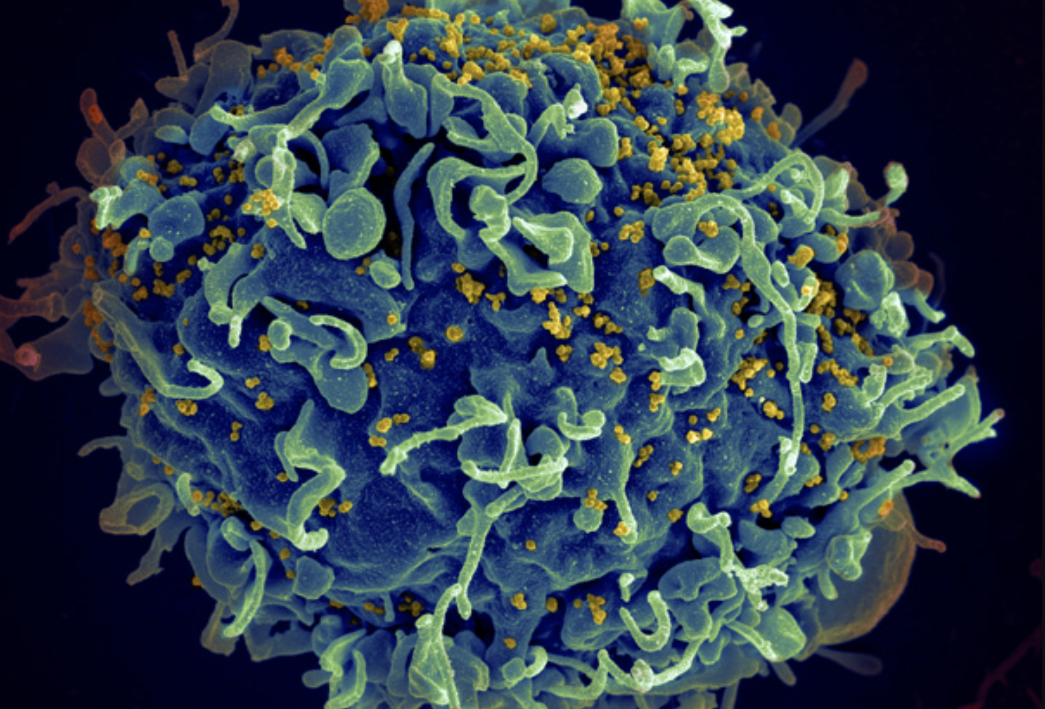 The Key to Exposing Hidden HIV Reservoirs Discovered | Drug Discovery ...