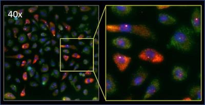 Tracking the Activity of a Cancer Gene | Genetics And Genomics