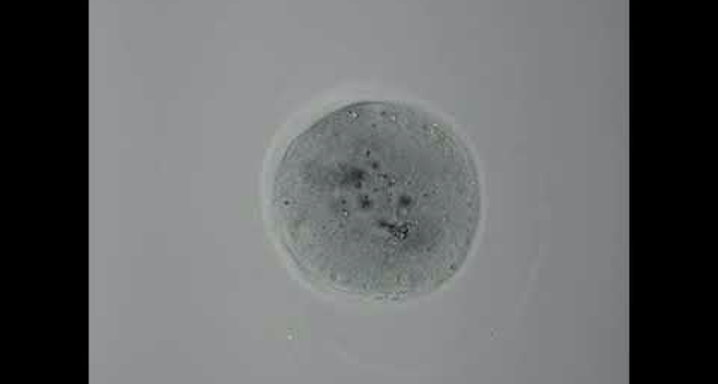 Scientists Link Three Genes to Miscarriage | Genetics And Genomics