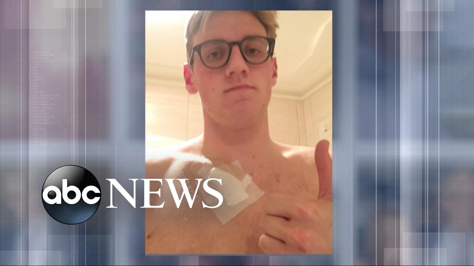 Possible Skin Cancer Spotted by Alert Fan | Videos