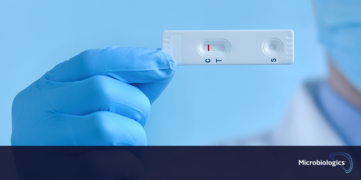 The Necessity of External Controls | Microbiology