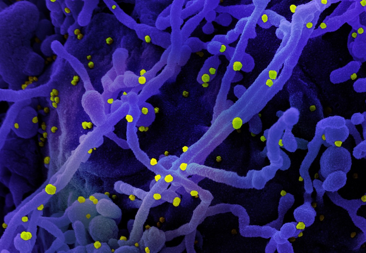 Researchers Reveal a Primary Driver of Organ Damage in COVID-19 ...