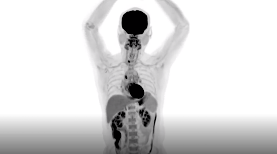 EXPLORER - Whole-Body Diagnostic Scans in About 30 Seconds | Videos