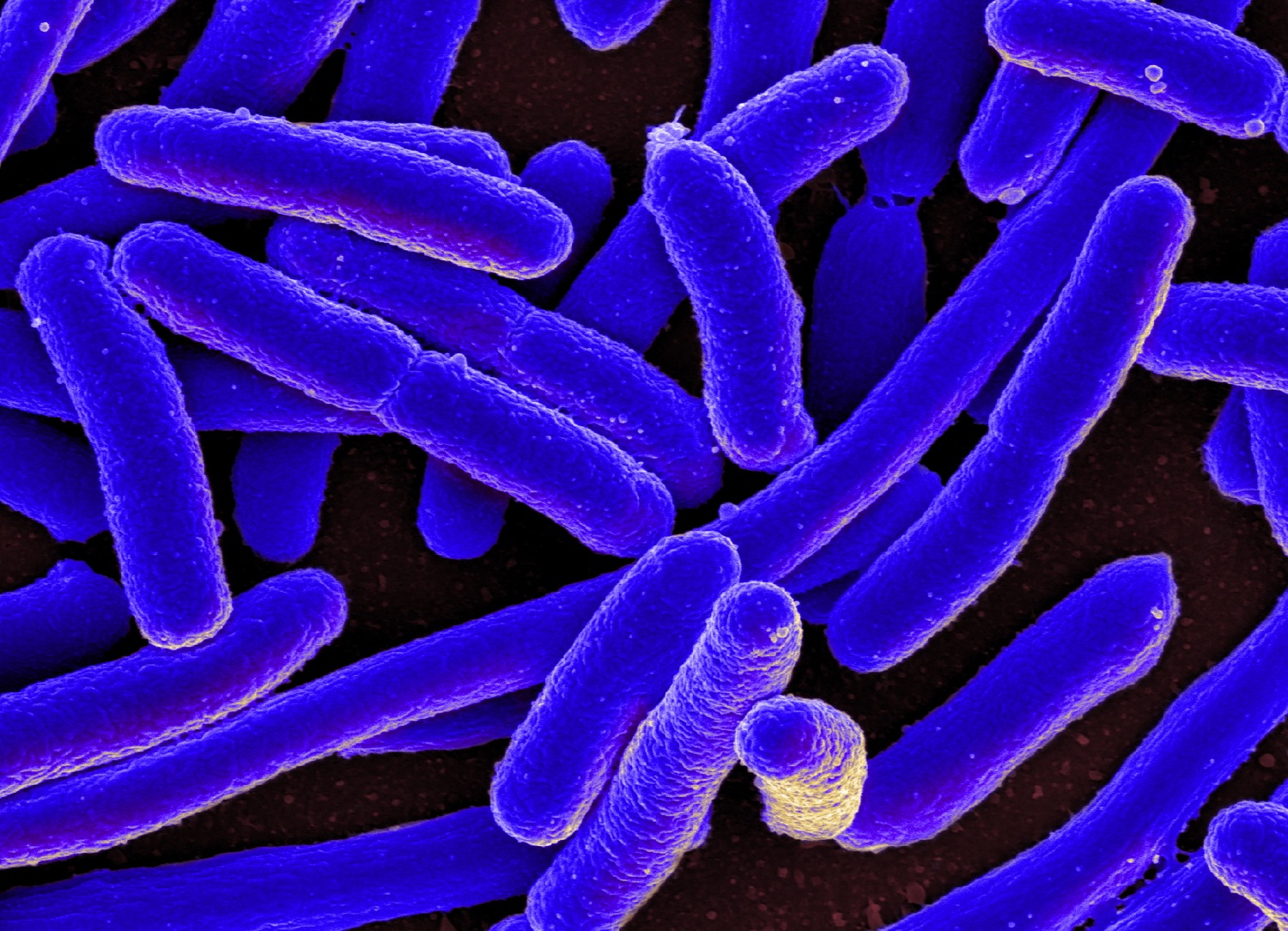 Iron-Scavenging Molecule may be key to UTI Prevention | Microbiology