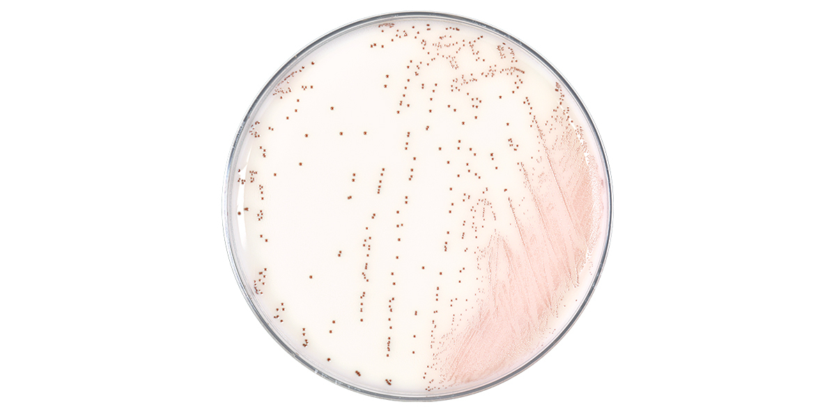 It's Strep Throat Season | Microbiology