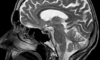 Getting Inside the Brain With Virtual Reality | Neuroscience