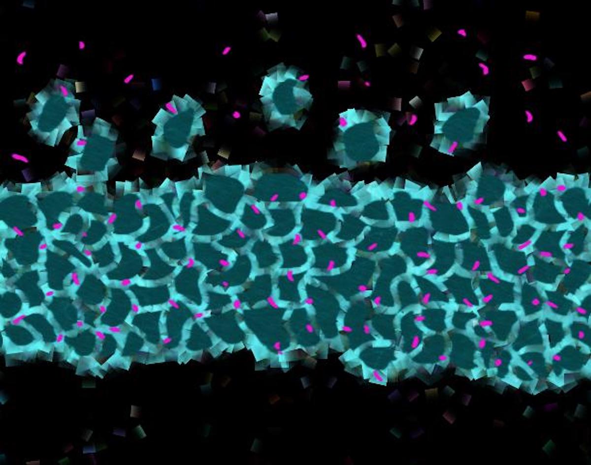 Fragile X Model Has a Very Specific Brain Abnormality | Cell And ...