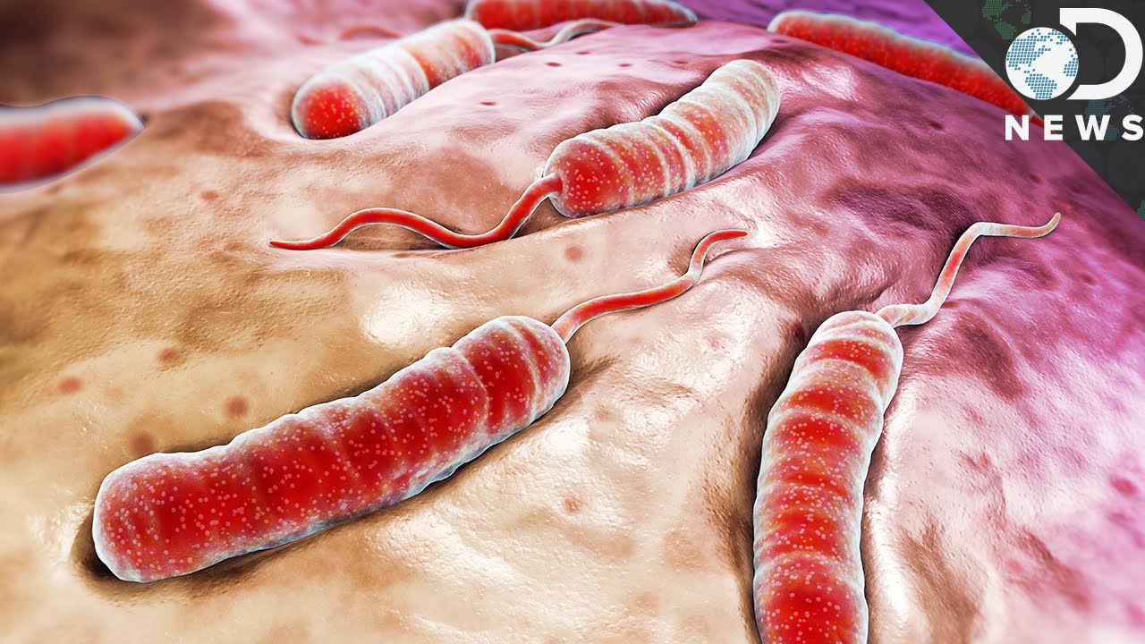 How Cholera Affects the Body | Videos