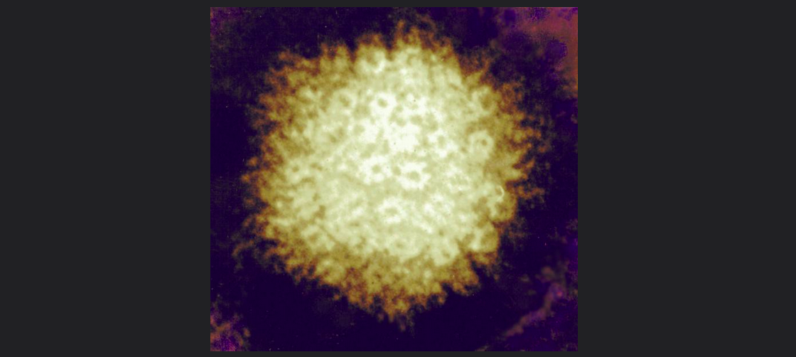 Understanding the Connection Between Stroke and Shingles | Cell And ...