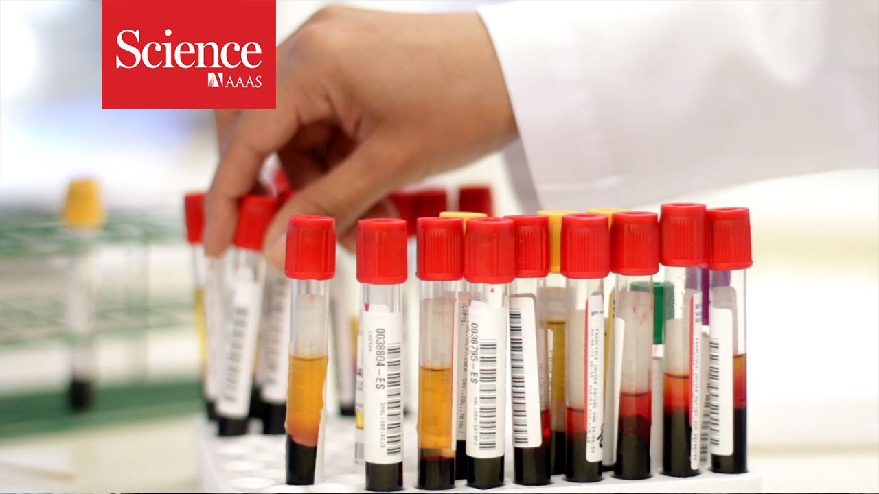 Simple Test can now Determine Blood Type in Seconds | Videos