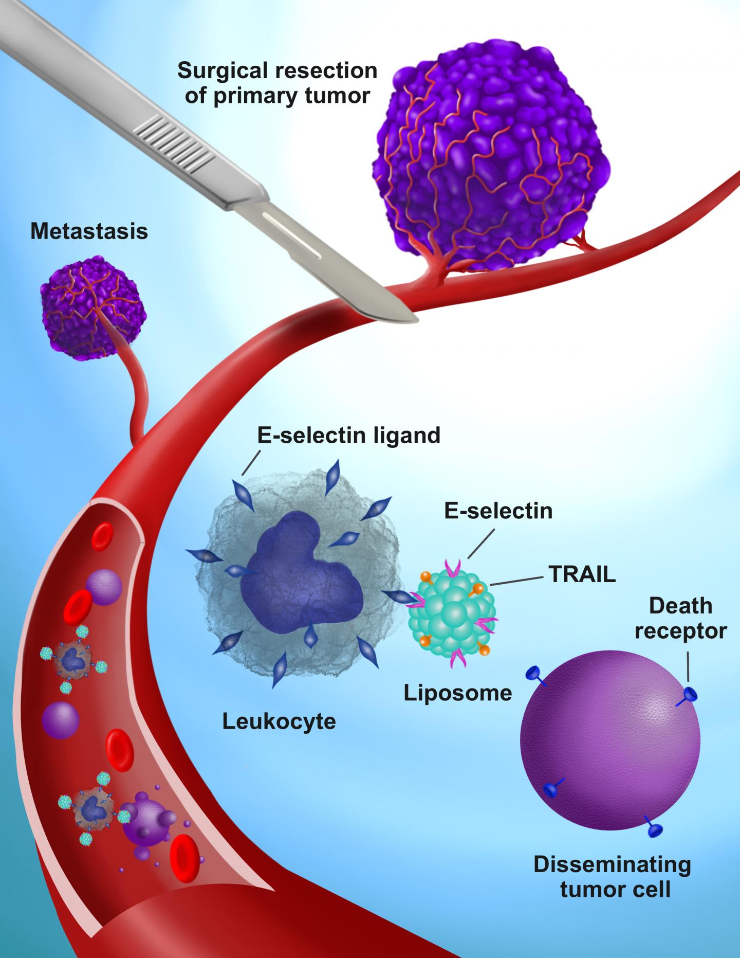 Stopping Metastasis After Breast Cancer Surgery | Cell And Molecular ...