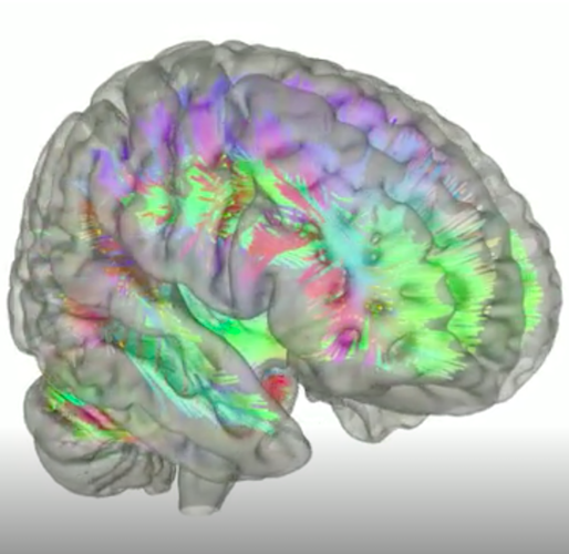 EEG Helps Determine the Right Depression Treatment | Clinical And ...