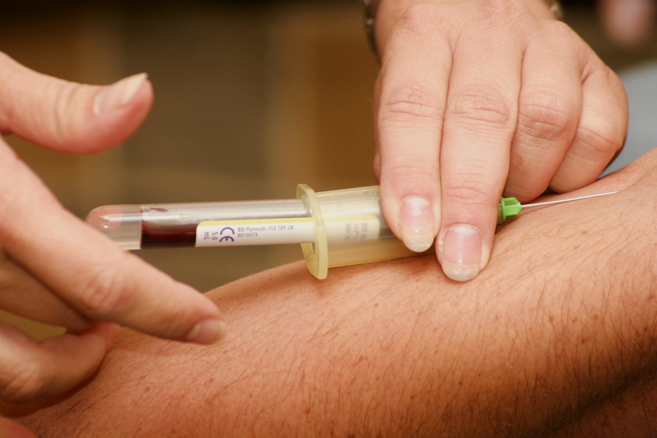 IV Treatment for Traumatic Brain Injury | Drug Discovery And Development