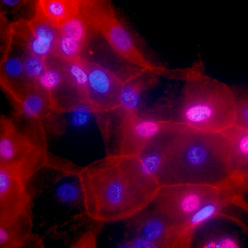 Cancer Cell Lines can Evolve in the Lab | Cell And Molecular Biology