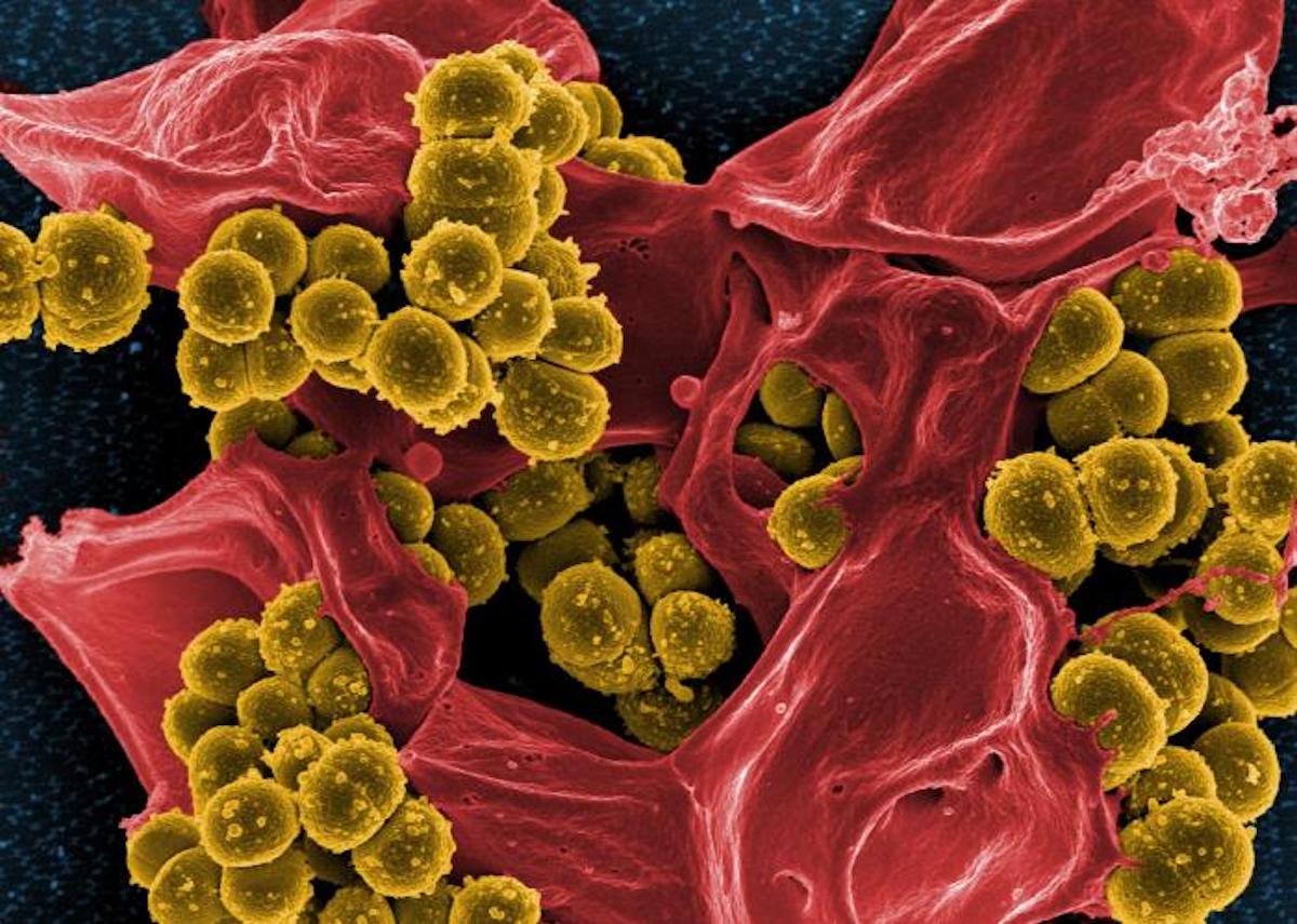 'Living Medicines' to Destroy Dangerous Biofilms | Microbiology