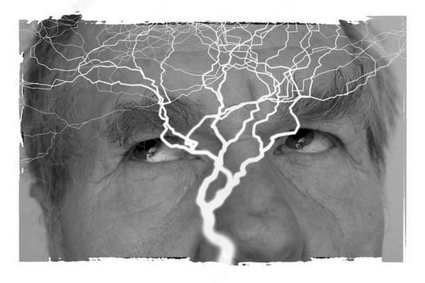 Mapping the Brain Before Surgery for Epilepsy | Neuroscience