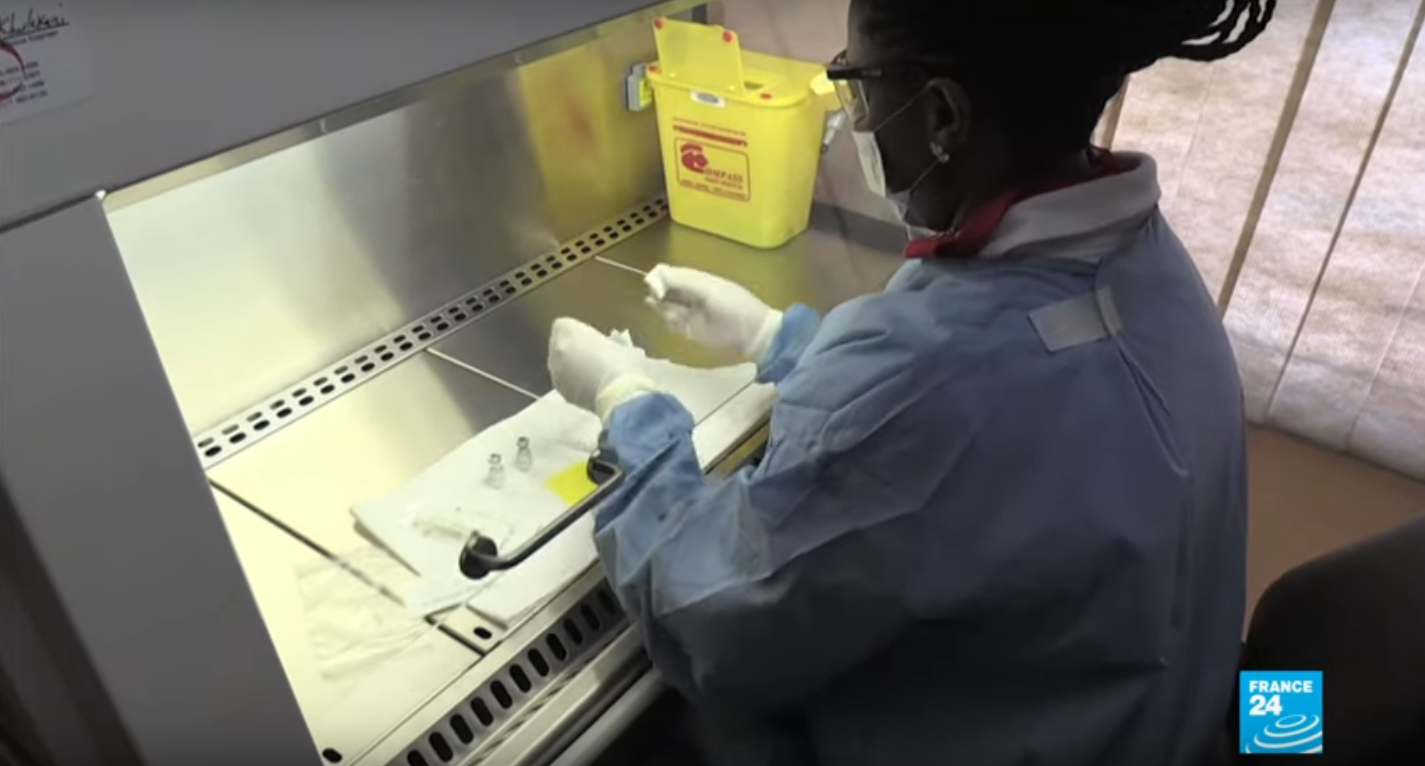 A Second Person Has Been Cured of HIV | Microbiology