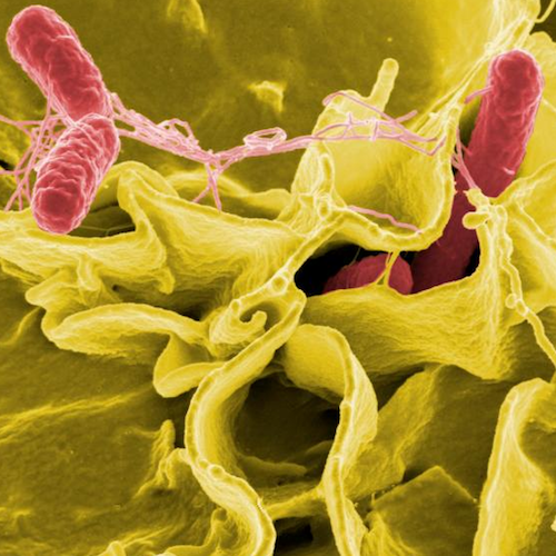 Cause of Colonial-era Epidemic Identified | Genetics And Genomics