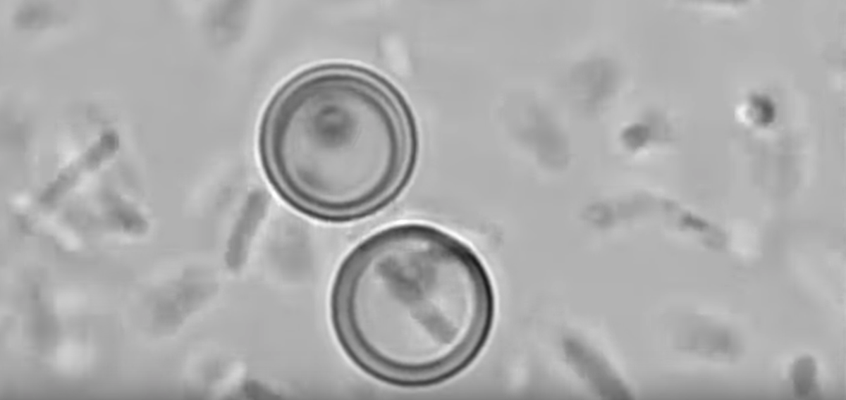 New Artificial Cells Can Ingest, Process & Expel Material | Cell And ...
