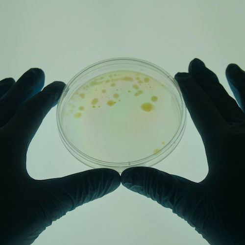 Beating Stress with Bacteria | Microbiology