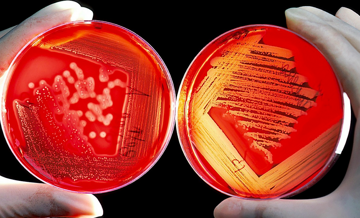 To Understand the Gut Microbiome, Researchers Create New Method to ID ...