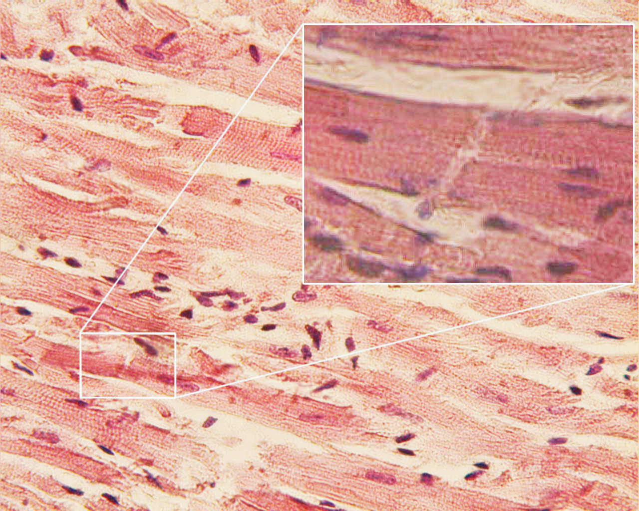 Protein Clusters Keep Heart Muscle Cells Beating in Sync | Cardiology