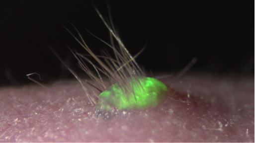 First Lab-Grown Skin to Sweat and Grow Hair | Clinical And Molecular Dx