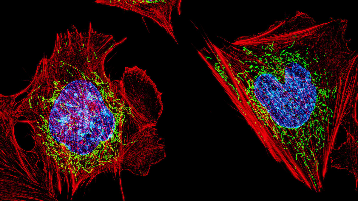 Solving the Mystery of Nuclear Speckles | Cell And Molecular Biology