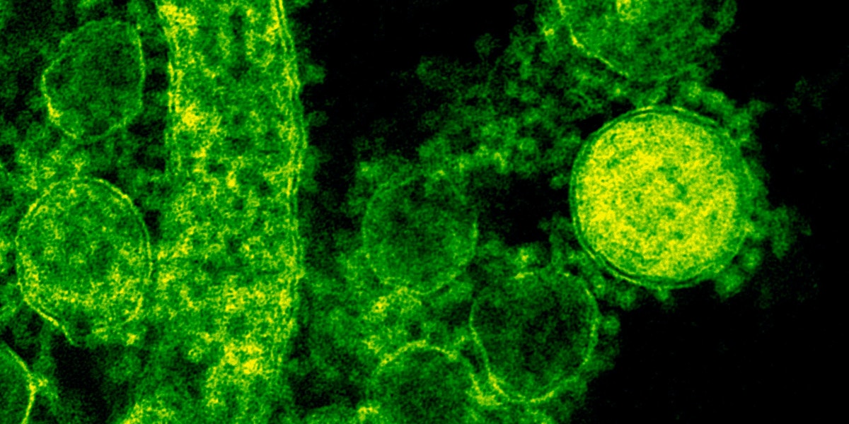 New Sensor Helps Determine How Bacteria Will Respond to Antibiotics ...