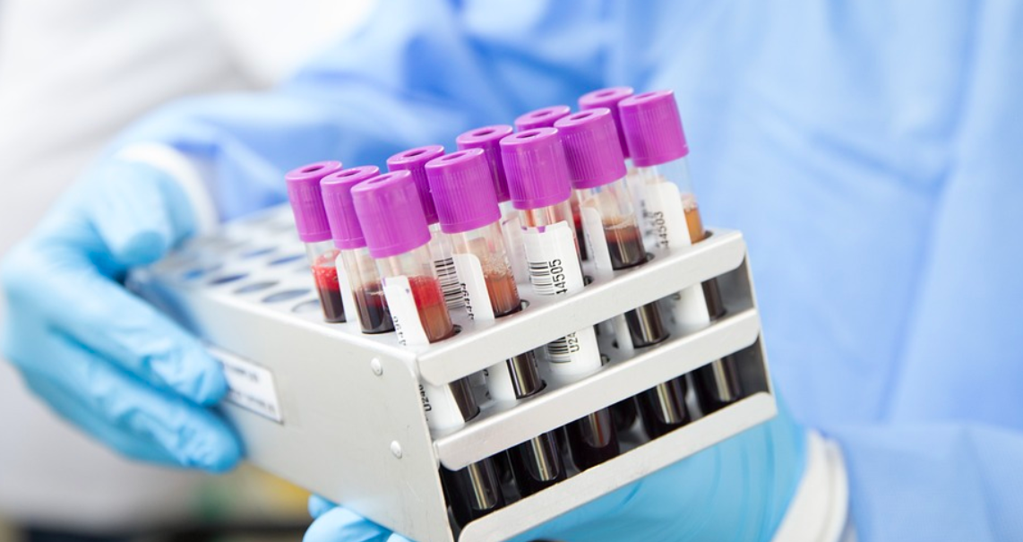 New Blood Test Could 'Transform' Diagnostics for Kids' Fevers ...