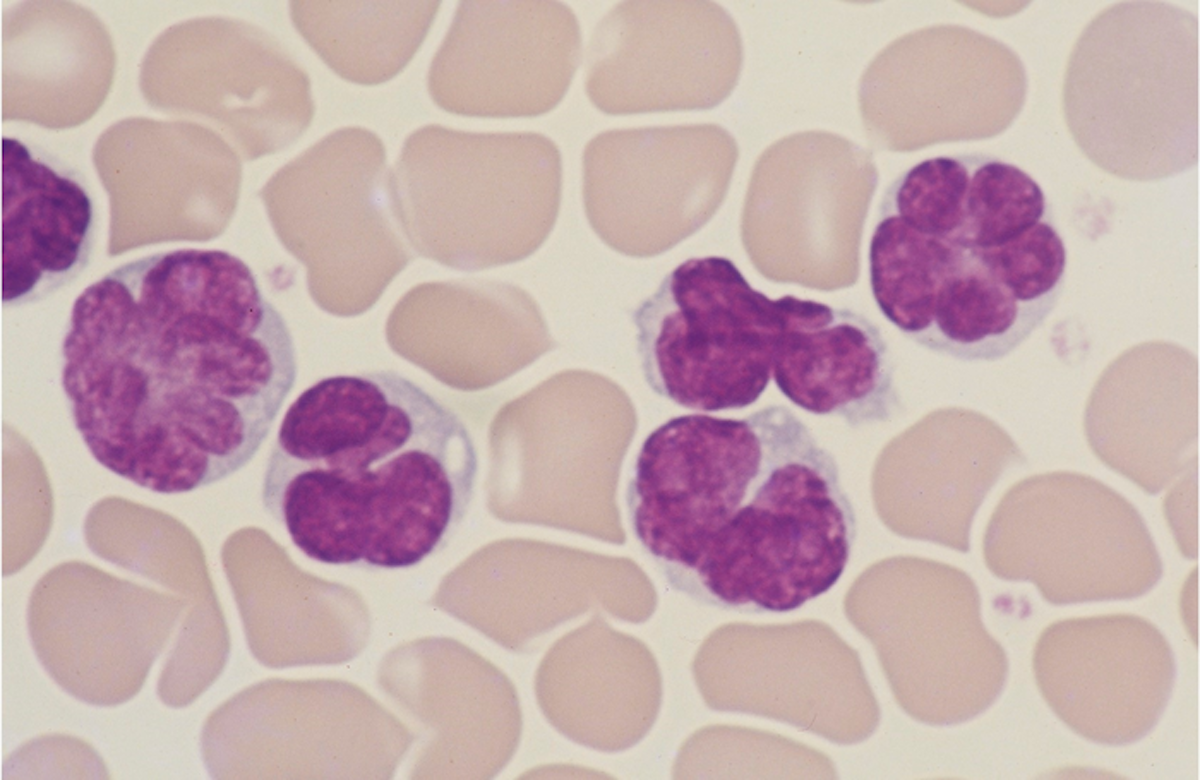 How The Htlv 1 Virus Can Turn Immune Cells Cancerous Cell And