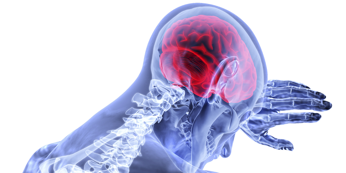 Identifying a Prognostic Biomarker for Neurological Deterioration After ...