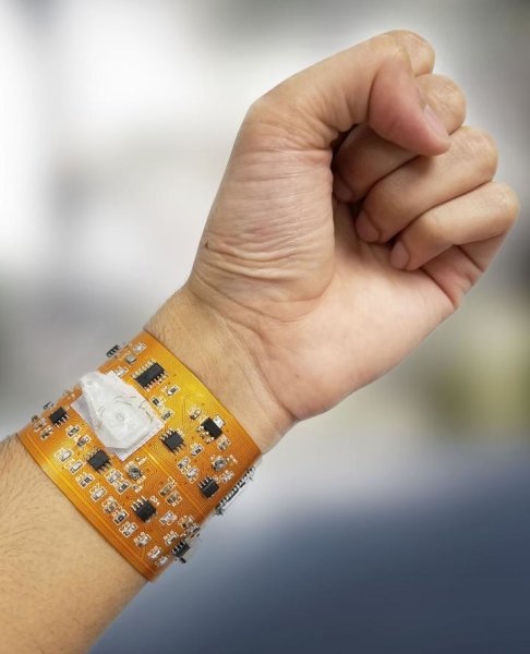 Smart Wristband Monitors Health | Technology