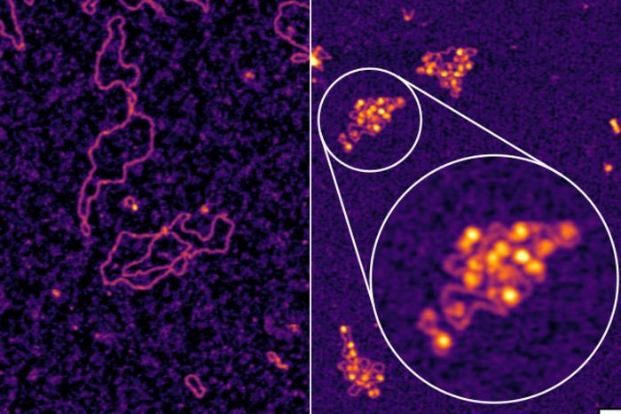 New Insights Into Hepatitis B Infection Reveal a Potential Treatment ...