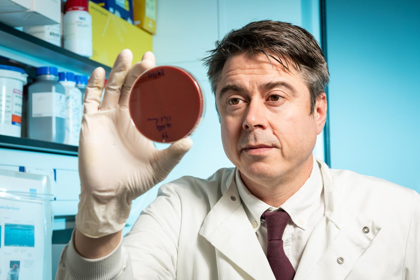 A Deadly Microbe is Lurking on the Skin of Many People | Microbiology