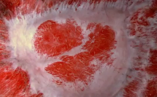 Fat Cells Help Wounds Heal as Healthy Skin Instead of Scars | Cell And ...