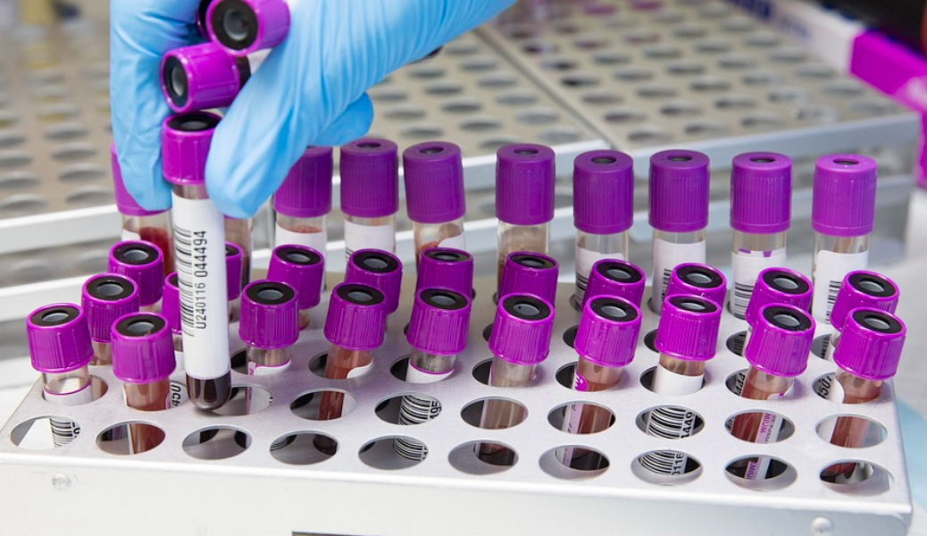 A New Non-Invasive Prenatal Testing Tool is Created | Clinical And ...