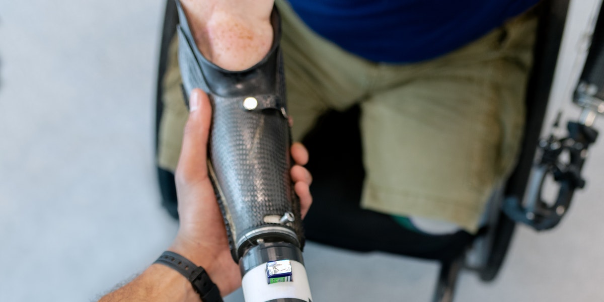 "Bionic" Arm Effective at Restoring Arm Function in Amputees | Technology