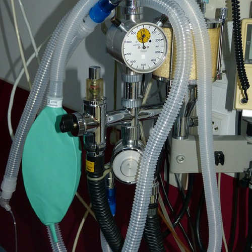 Is Your Brain Completely Unconscious During Anesthesia? | Videos