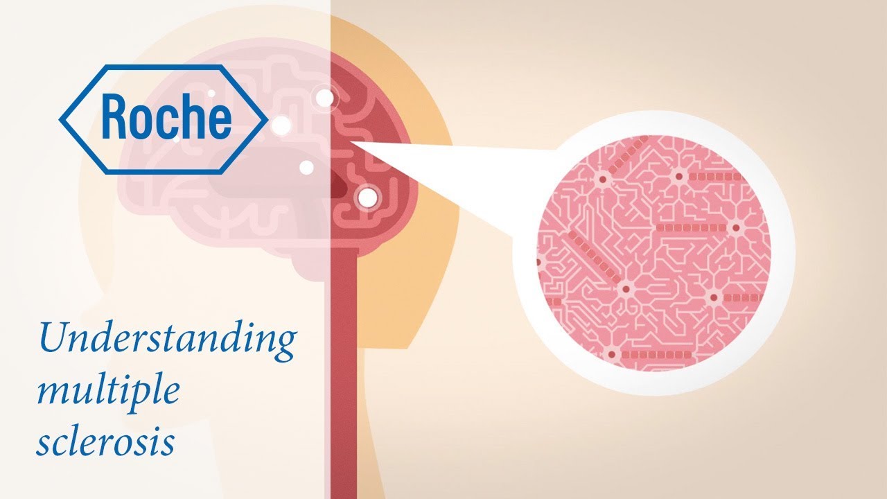 Information about Multiple Sclerosis and the Brain | Videos